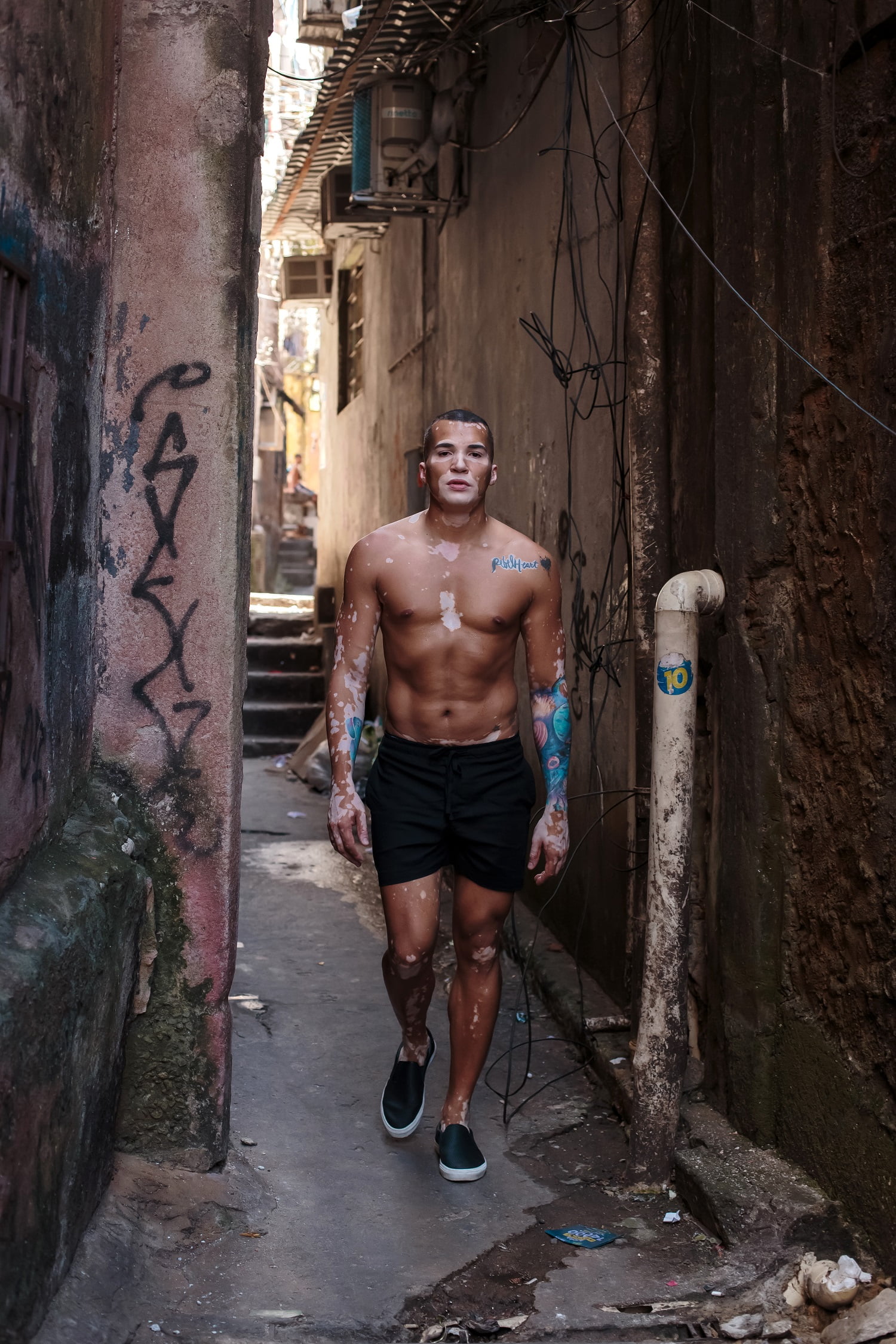 Morador da Rocinha com vitiligo vira modelo aos 35 anos: ‘Escondi as ...